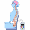 xStep | Neuromodulation Therapy for Walking & Balance (x step)